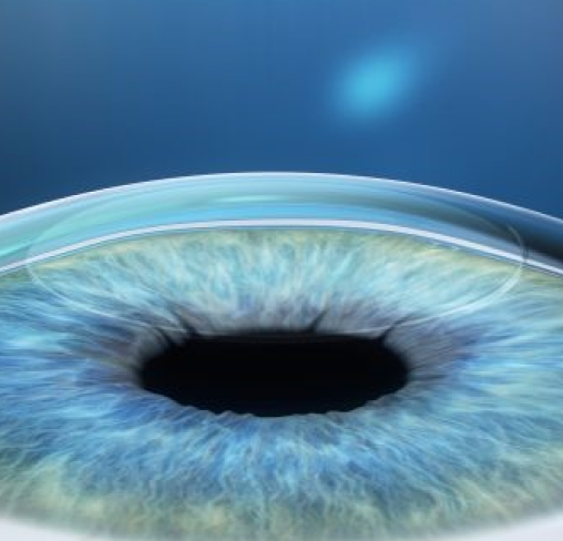 SMILE Pro: Transform Your Vision with Advanced Smile LASIK Technology