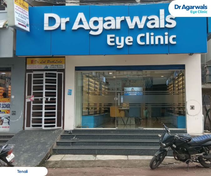 Best Eye Clinic Near Me in Guntur | Dr Agarwals Eye Hospital